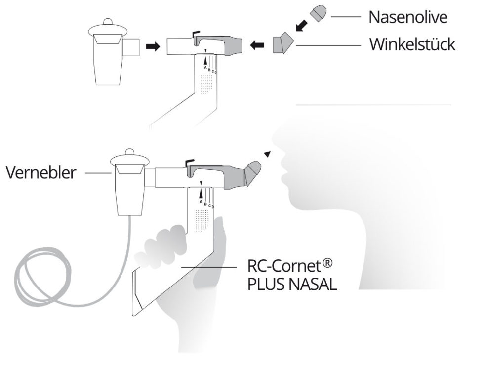 RC-Cornet® PLUS NASAL OPEP Atemtherapiegerät